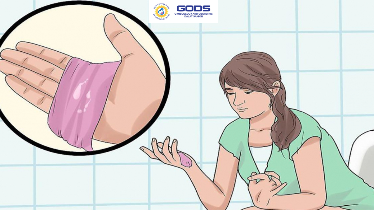 Cách Chữa Khí Hư Bã Đậu Tại Nhà: Hiệu Quả và An Toàn Bệnh Phụ Khoa ...