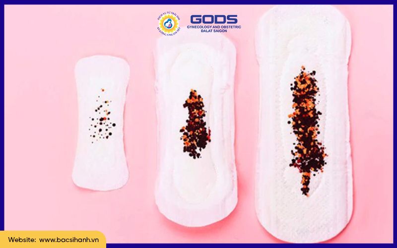 Rong Kinh Ra Ít Máu Có Đáng Lo Ngại Không? Bệnh Phụ Khoa - Bác Sĩ Hạnh